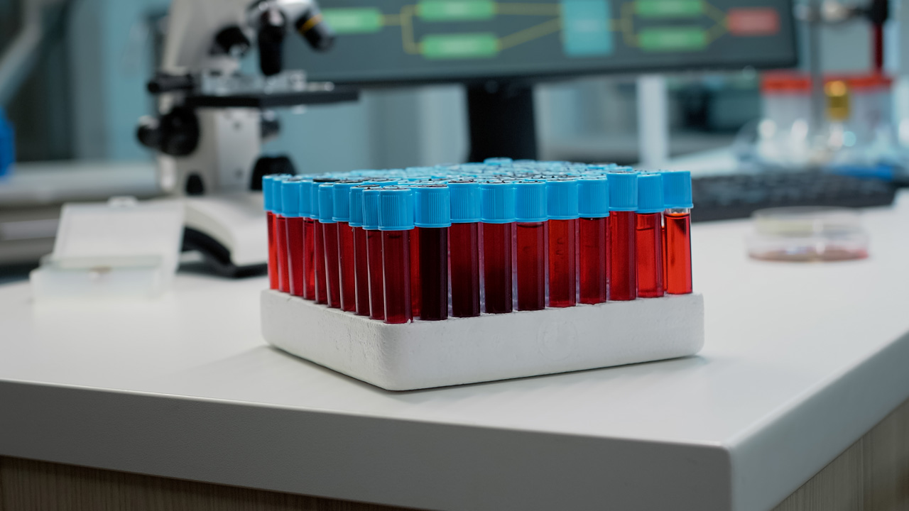 The Vital Role of Blood Collection Tubes in Modern Diagnostics – S S ...